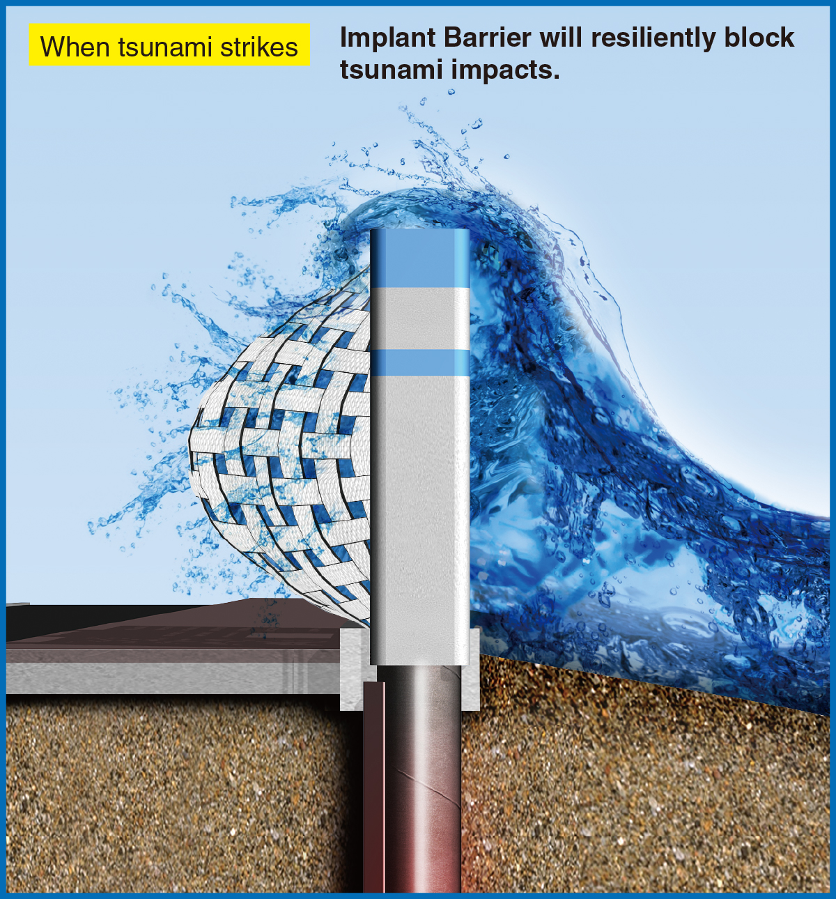 Implant Barrier – RED HILL 1967